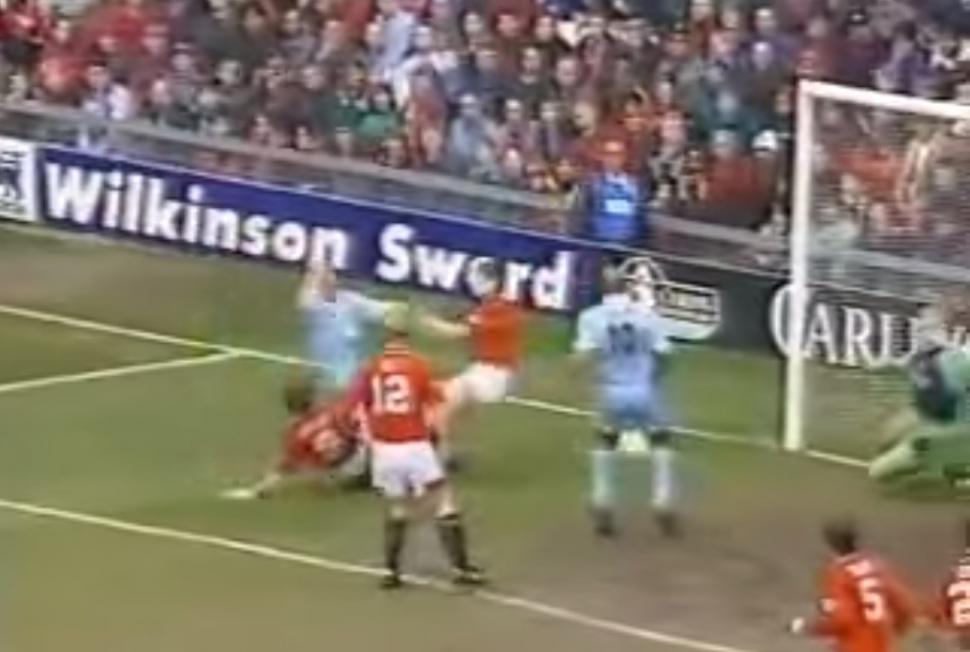 David Busst mostró las cicatrices de la lesión que hace 20 años lo ...